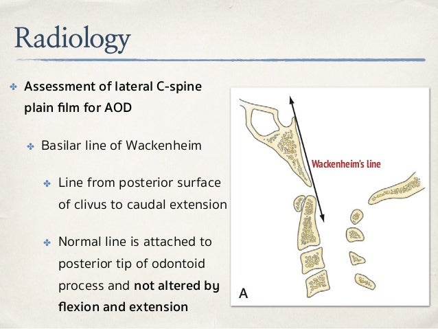 313 AOD and 314 AARS