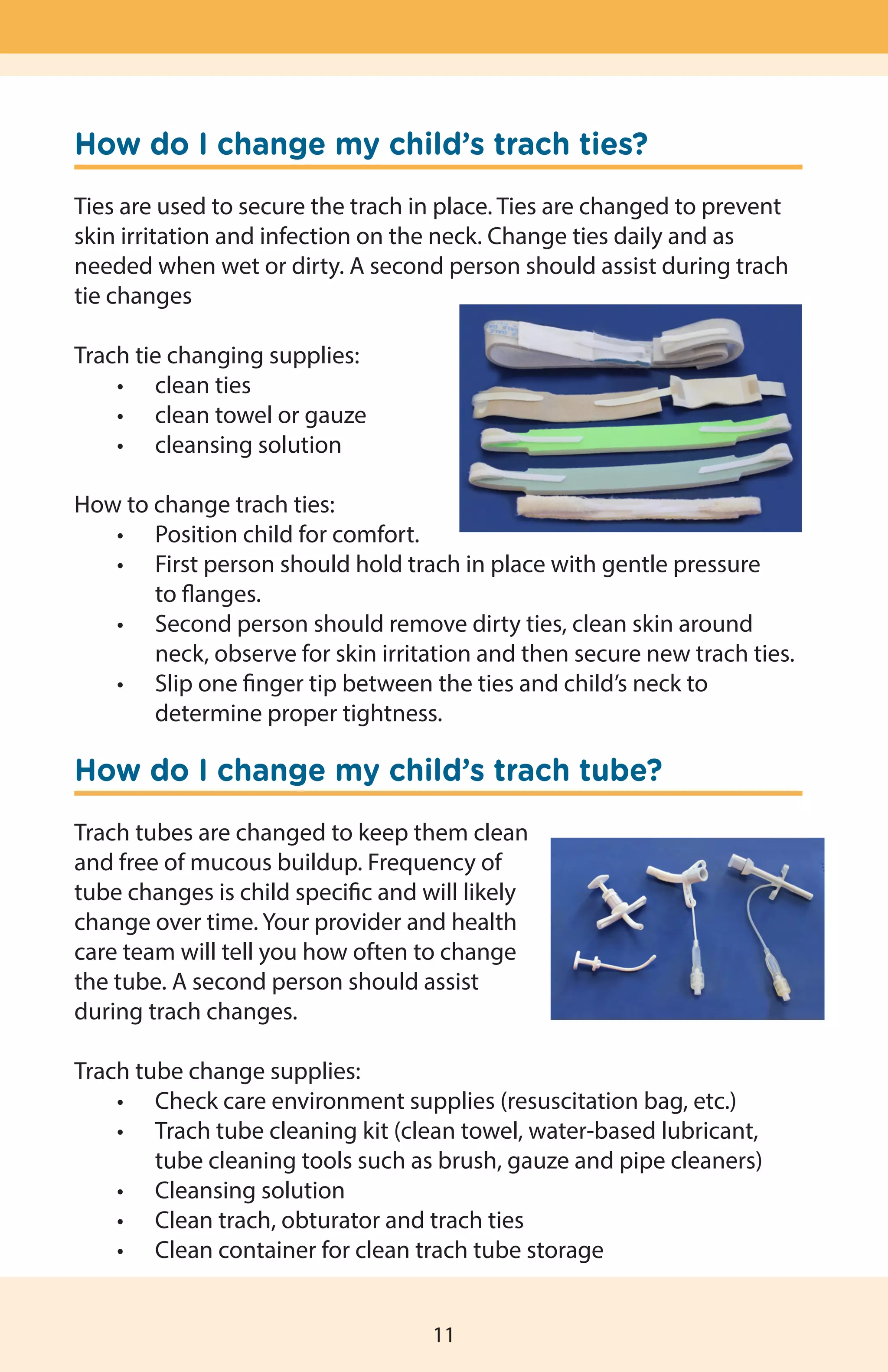 What You Need to Know About Your Child's Tracheostomy | PDF
