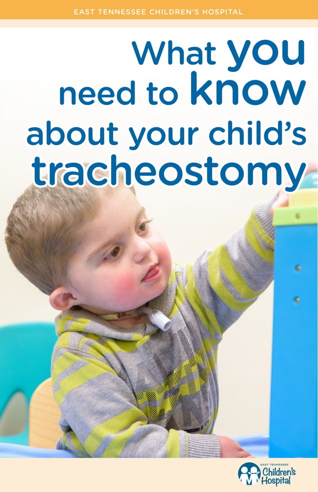 What You Need to Know About Your Child's Tracheostomy | PDF