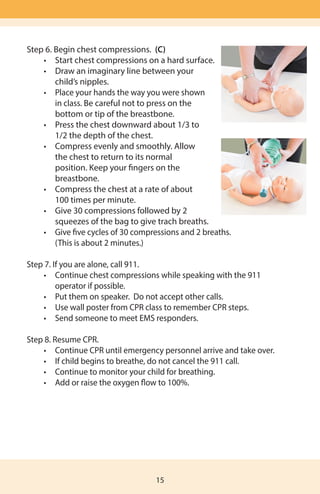 What You Need to Know About Your Child's Tracheostomy | PDF
