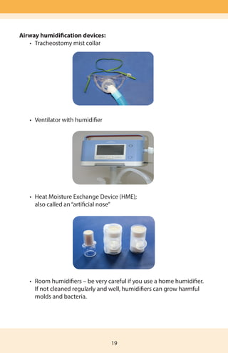 What You Need to Know About Your Child's Tracheostomy | PDF