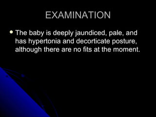 31555 jaundice in the newborn cpc | PPT