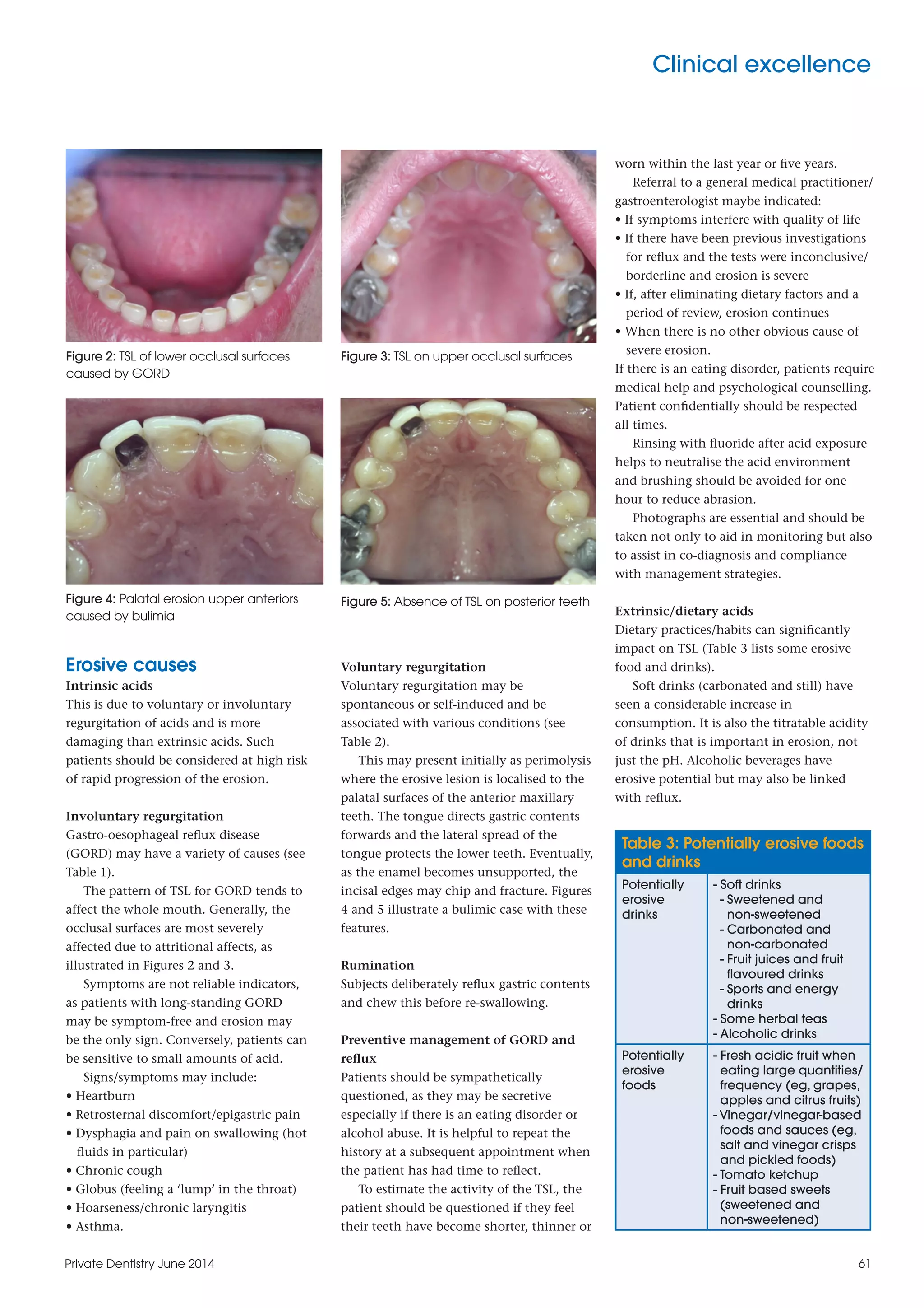 ToothSurfaceLoss_Part1 | PDF