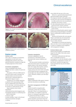 ToothSurfaceLoss_Part1 | PDF