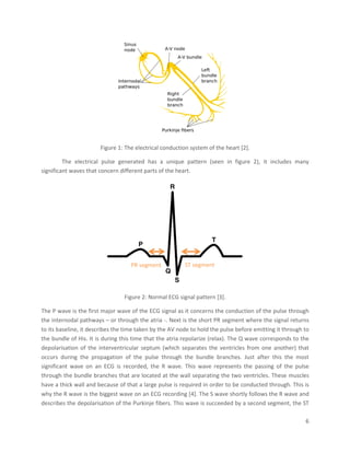3rd Year Project - Design and build of an Electrocardiogram | PDF