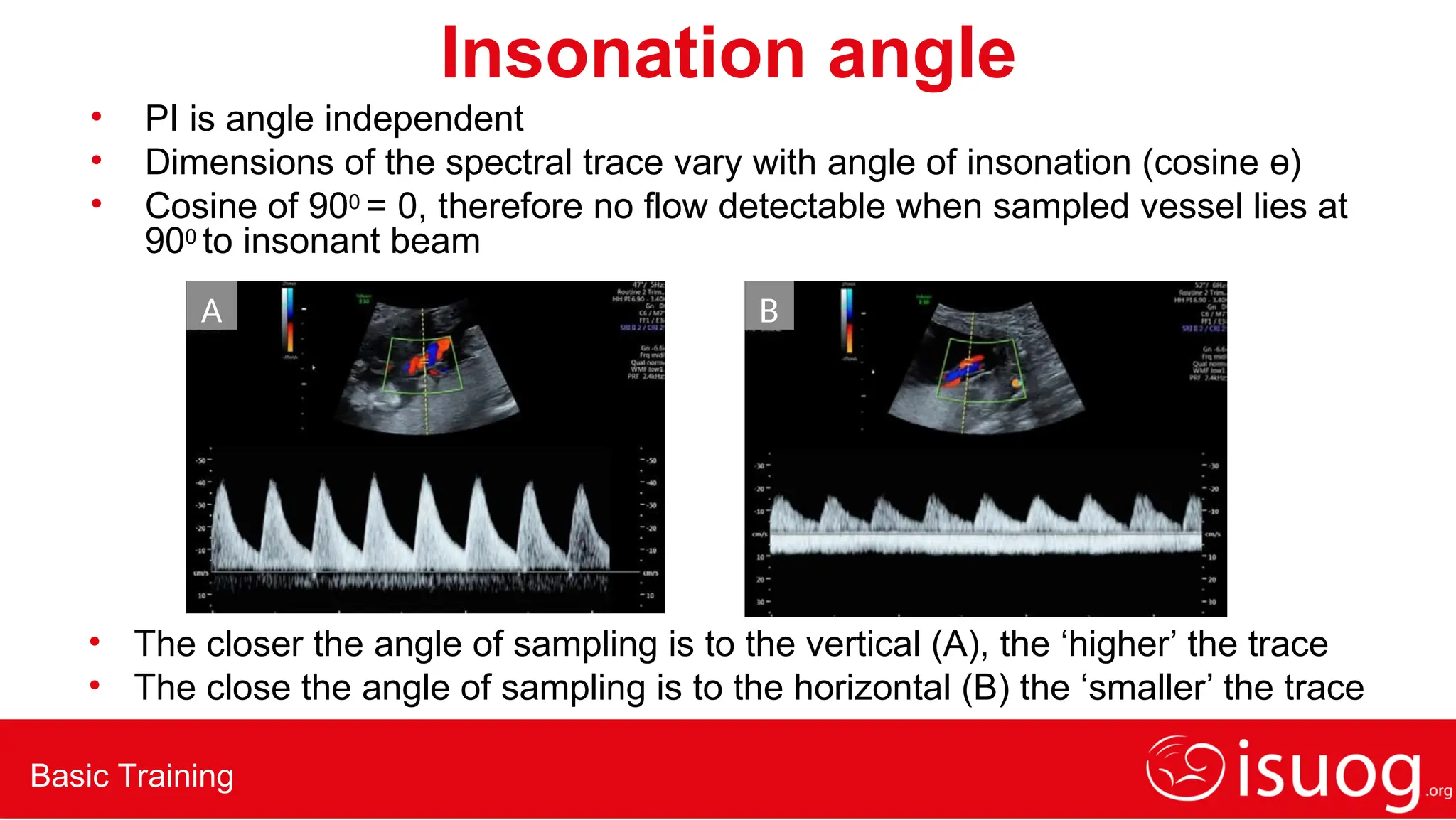 316. Lecture-3-The-principles-of-Doppler-ultrasound-AC (1).ppt
