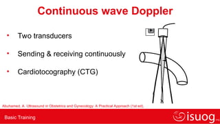 316. Lecture-3-The-principles-of-Doppler-ultrasound-AC (1).ppt