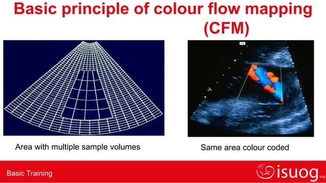 316. Lecture-3-The-principles-of-Doppler-ultrasound-AC (1).ppt