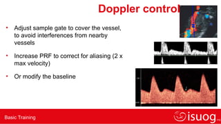 316. Lecture-3-The-principles-of-Doppler-ultrasound-AC (1).ppt