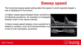 316. Lecture-3-The-principles-of-Doppler-ultrasound-AC (1).ppt