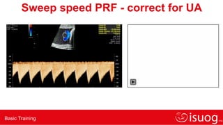 316. Lecture-3-The-principles-of-Doppler-ultrasound-AC (1).ppt