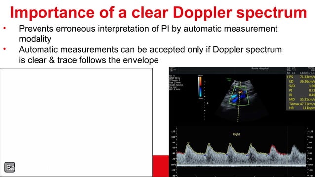 316. Lecture-3-The-principles-of-Doppler-ultrasound-AC (1).ppt