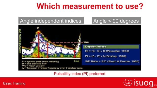 316. Lecture-3-The-principles-of-Doppler-ultrasound-AC (1).ppt