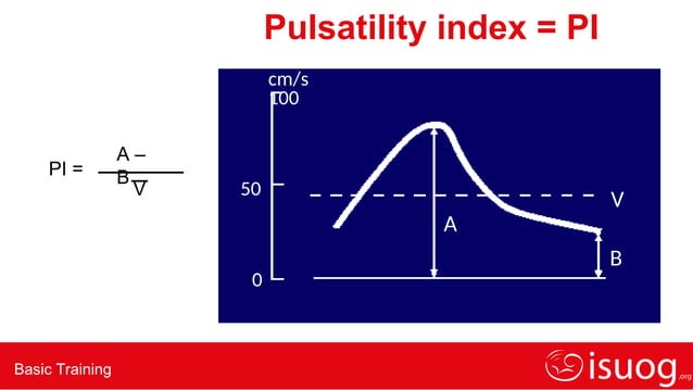 316. Lecture-3-The-principles-of-Doppler-ultrasound-AC (1).ppt