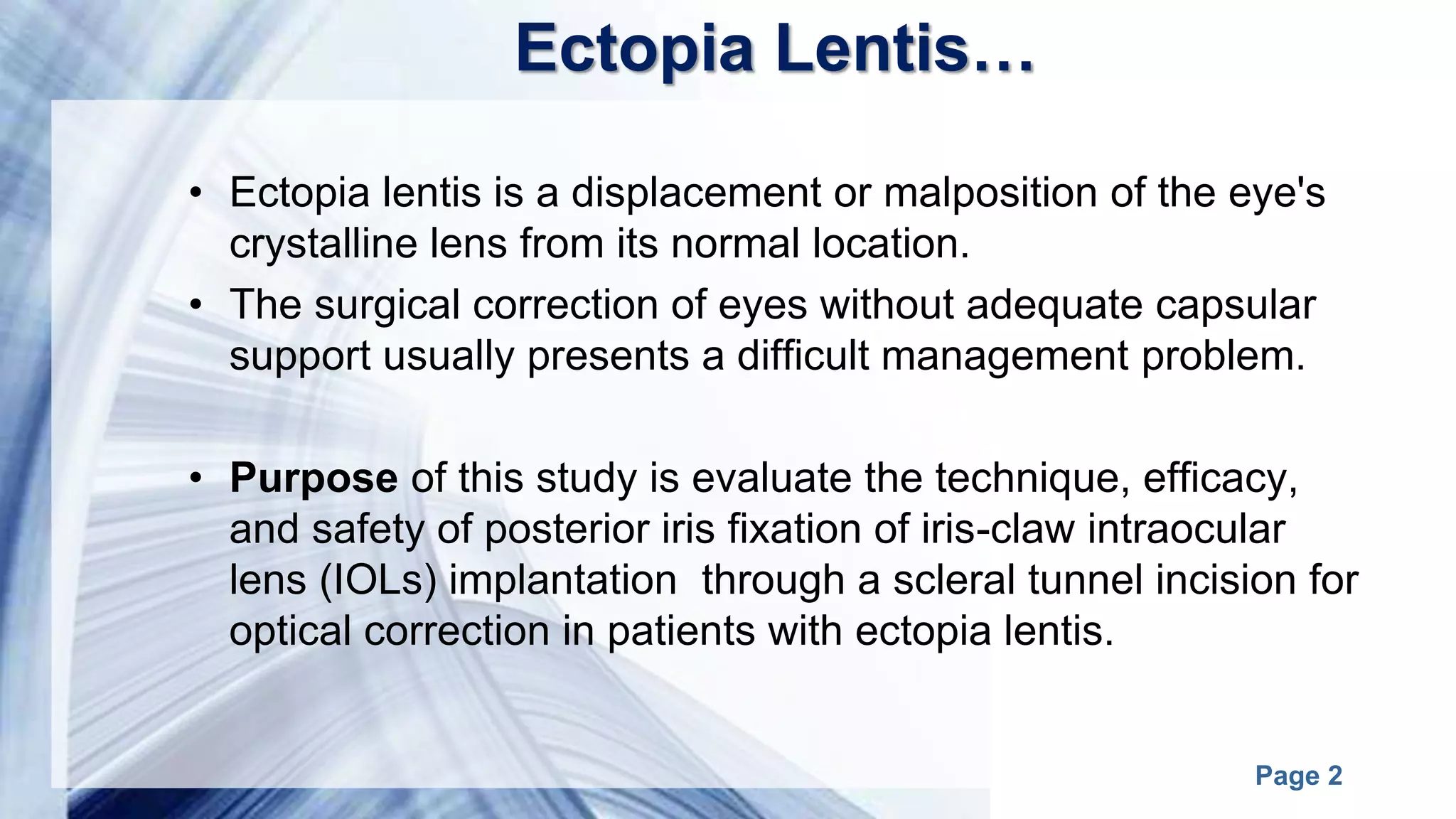 Save The Titanic Iris Fixated Iols In The Management Of Ectopia Lentis ...