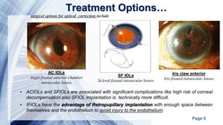 Save The Titanic Iris Fixated Iols In The Management Of Ectopia Lentis ...