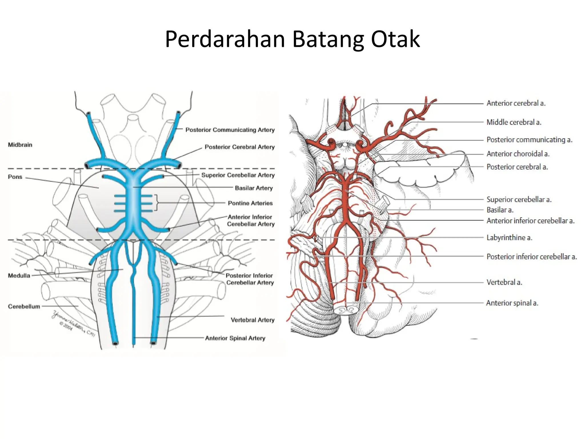 Sindrom-Batang-Otak, mesencephalon, pons, MOpptx | PPTX