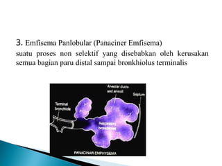 319865415-PPT-Emfisema-Paru-Radiologi.ppt