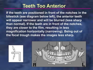 panoramic-techique errors | PPTX