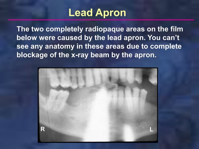 panoramic-techique errors | PPTX