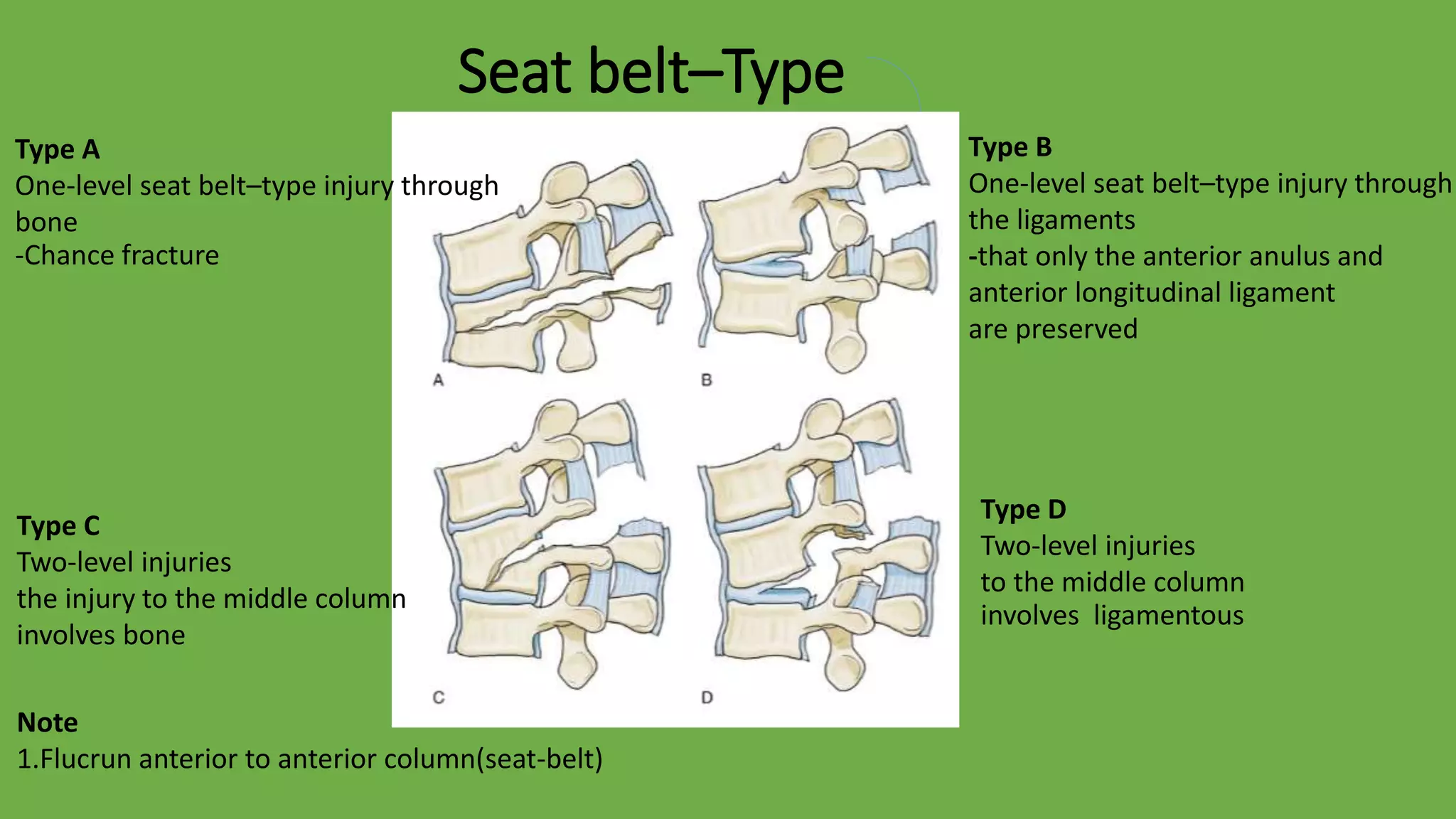 319 thoracolumbar trauma | PPTX
