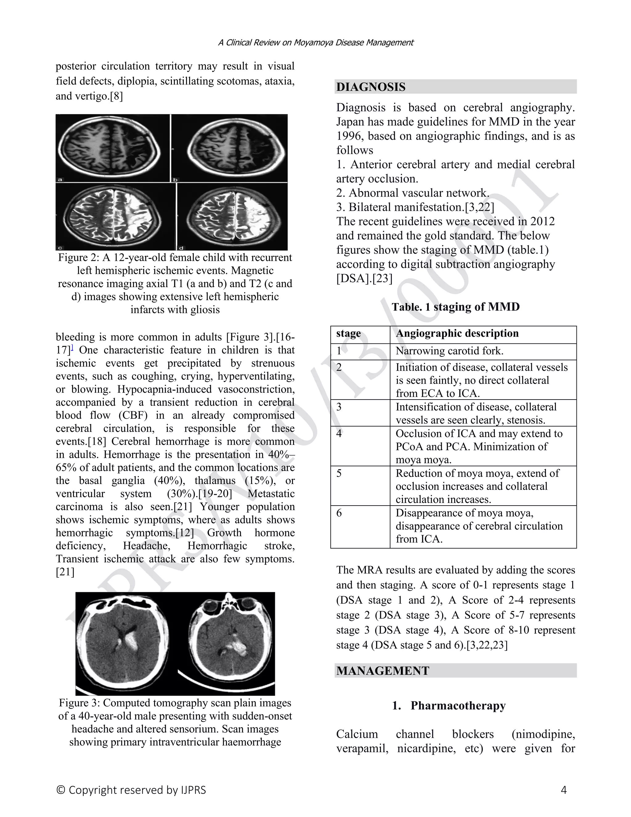 31 moya moya disease ijprs | PDF