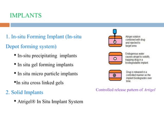 parentral controlled drug delivery system | PPT