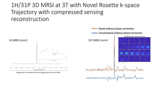 1H/31P 3D MRSI at 3T with Novel Rosette k-space Trajectory with compressed sensing ...