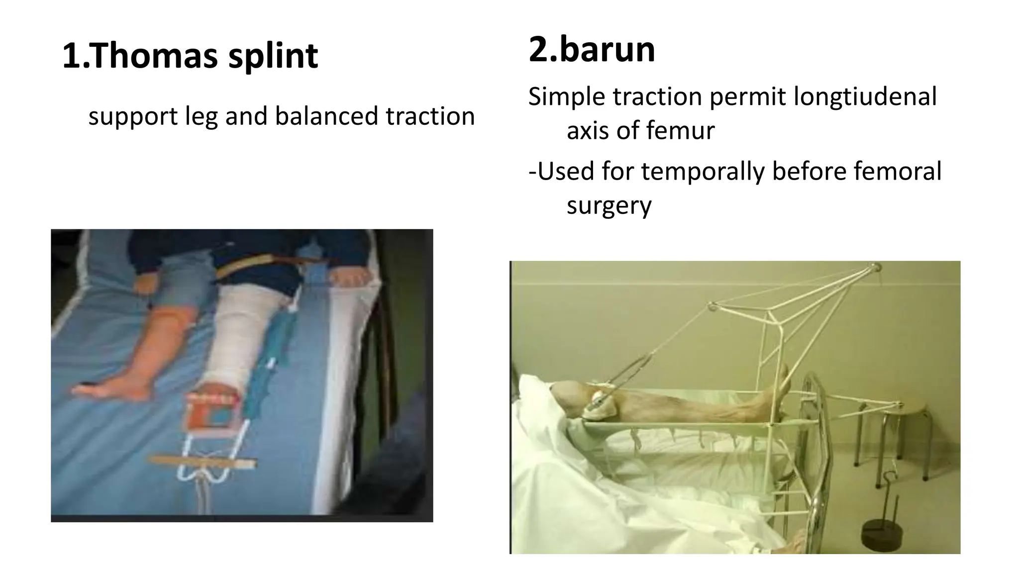 31,Principles of fracture management.pptx