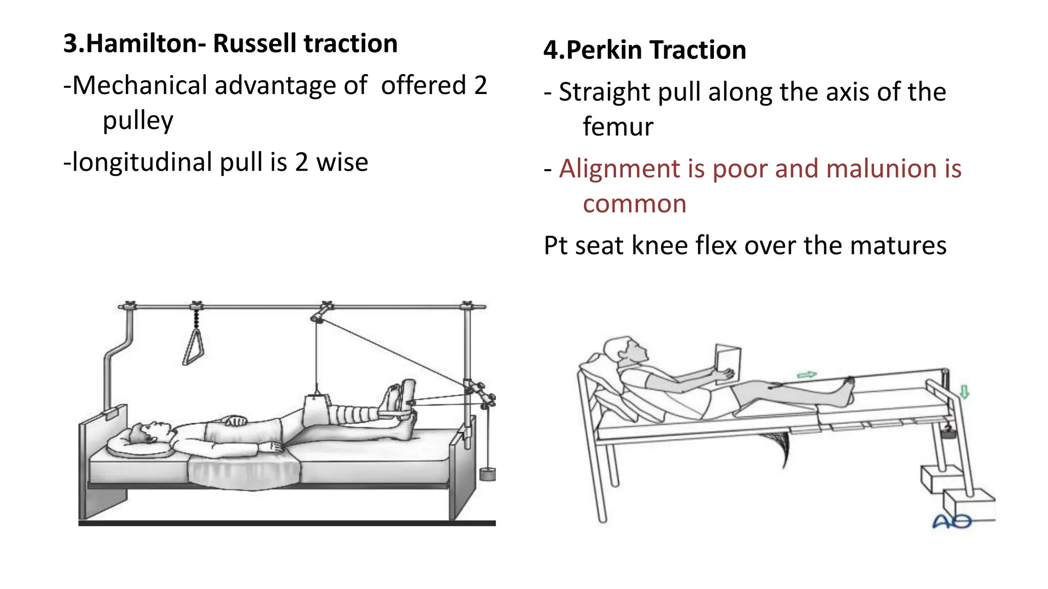31,Principles of fracture management.pptx