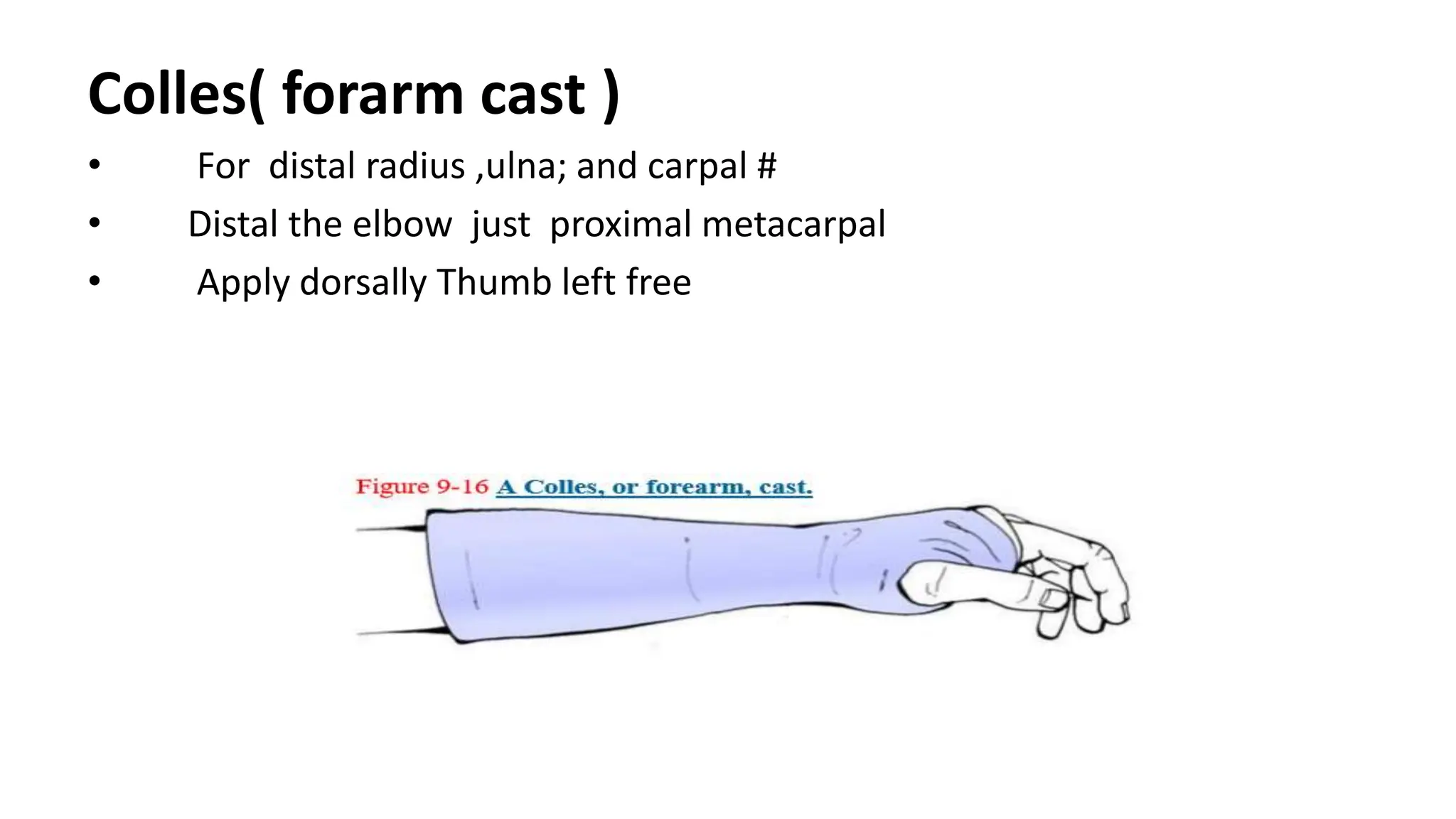 31,Principles of fracture management.pptx