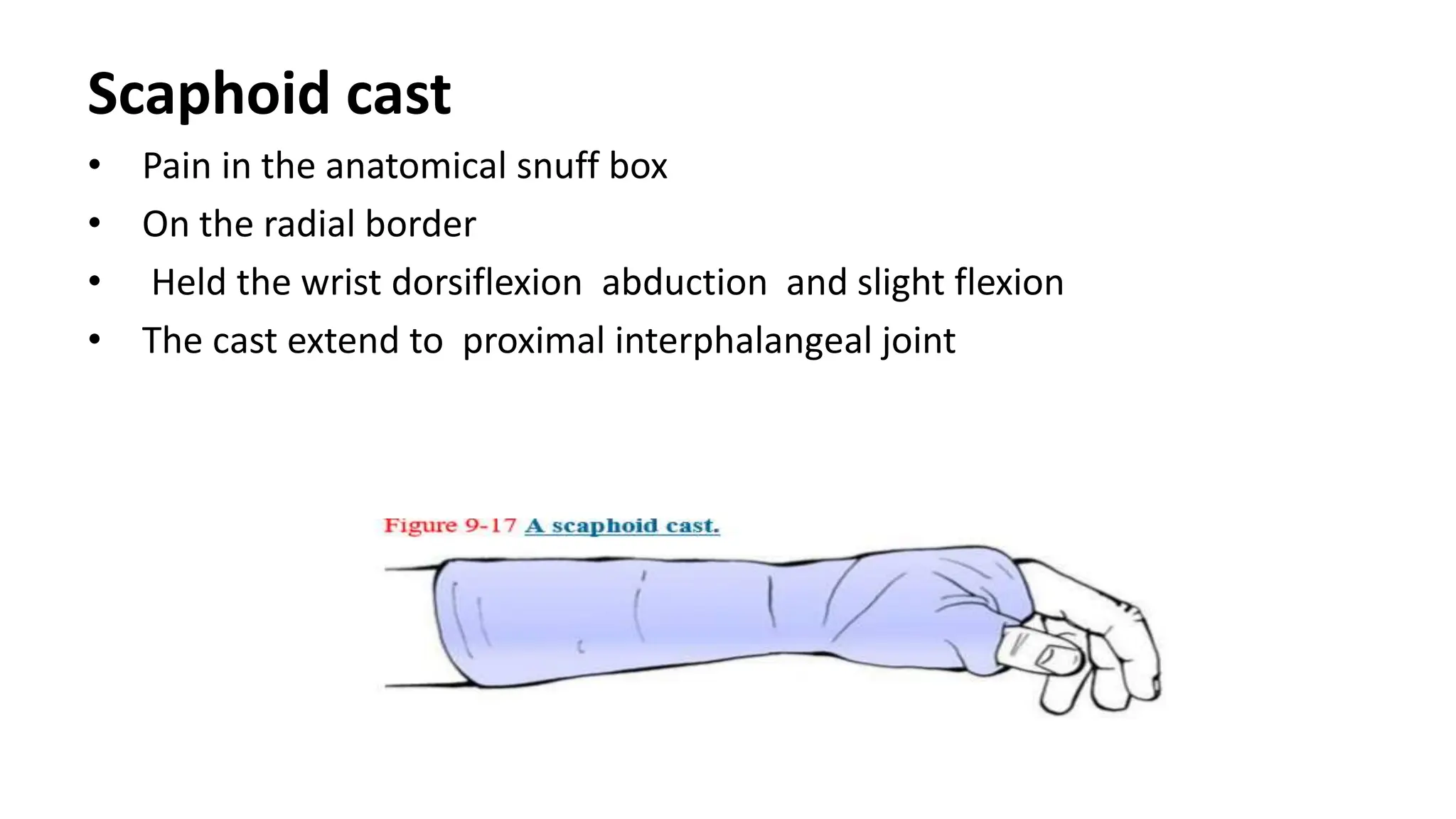 31,Principles of fracture management.pptx