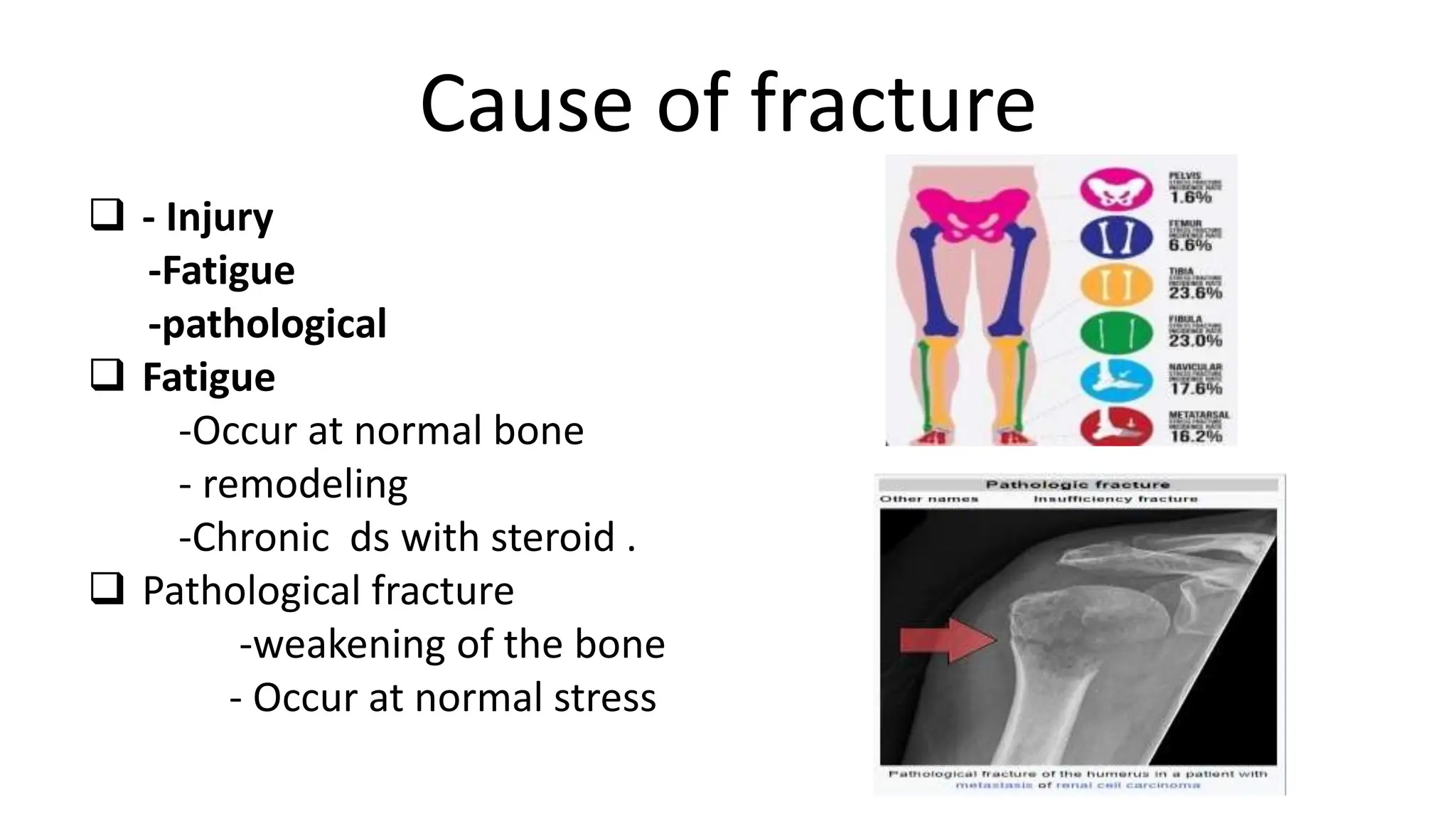 31,Principles of fracture management.pptx