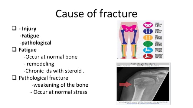 31,Principles of fracture management.pptx