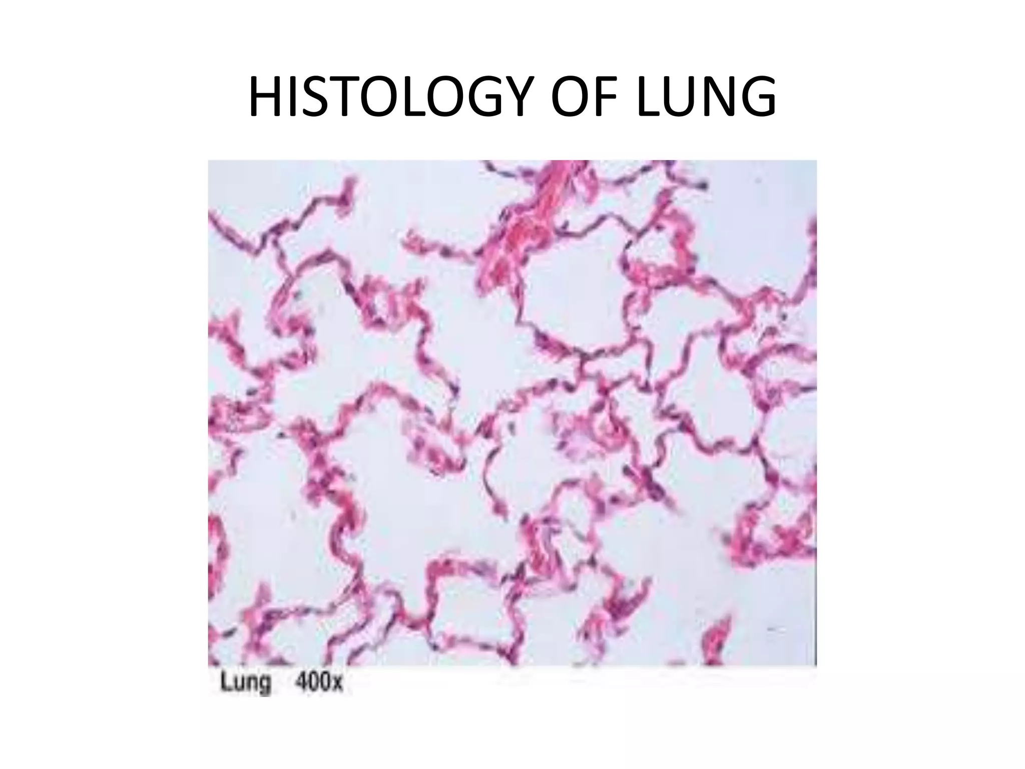 31 Pulmonary embolism and infarction..pptx