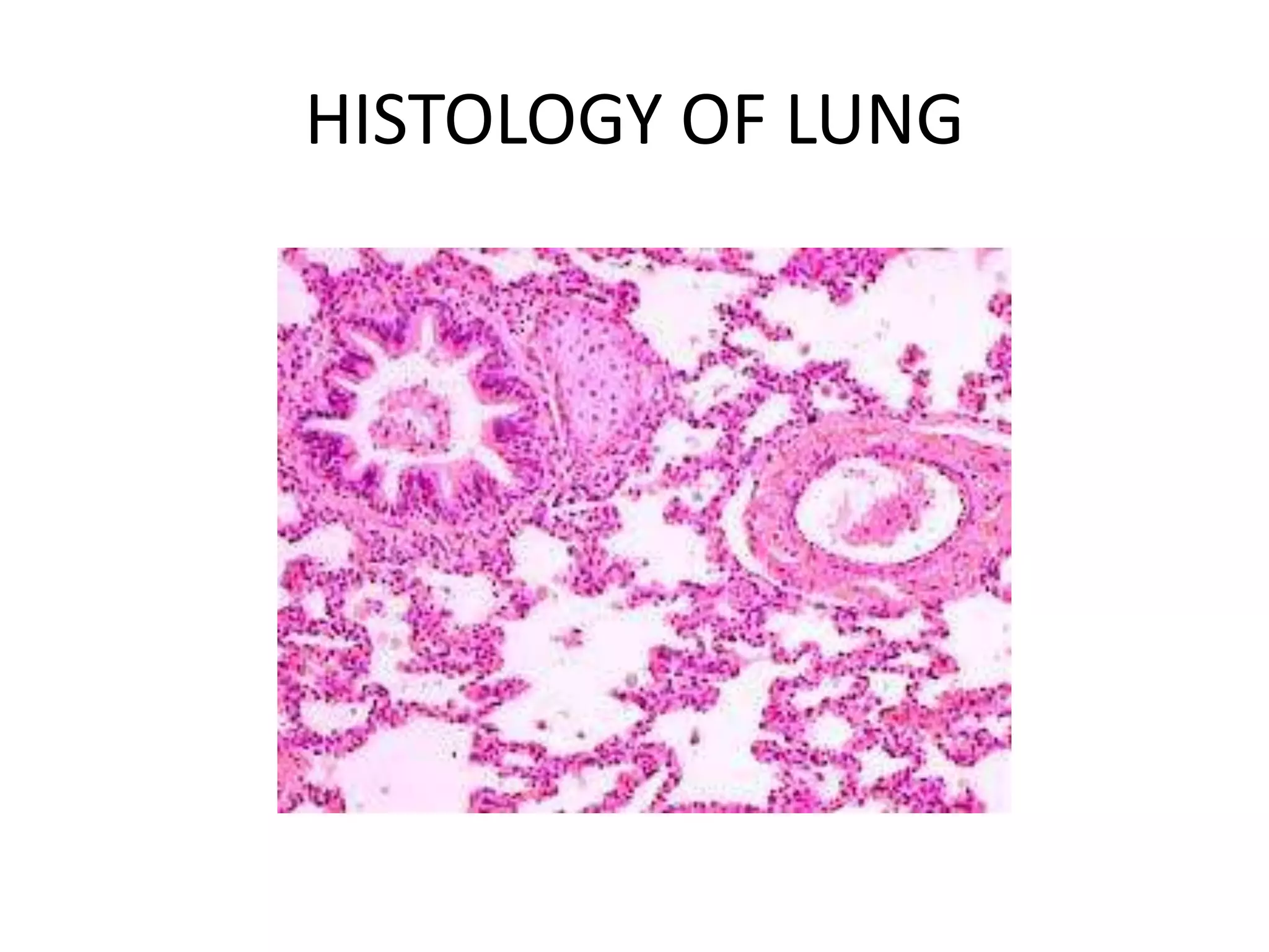 31 Pulmonary embolism and infarction..pptx