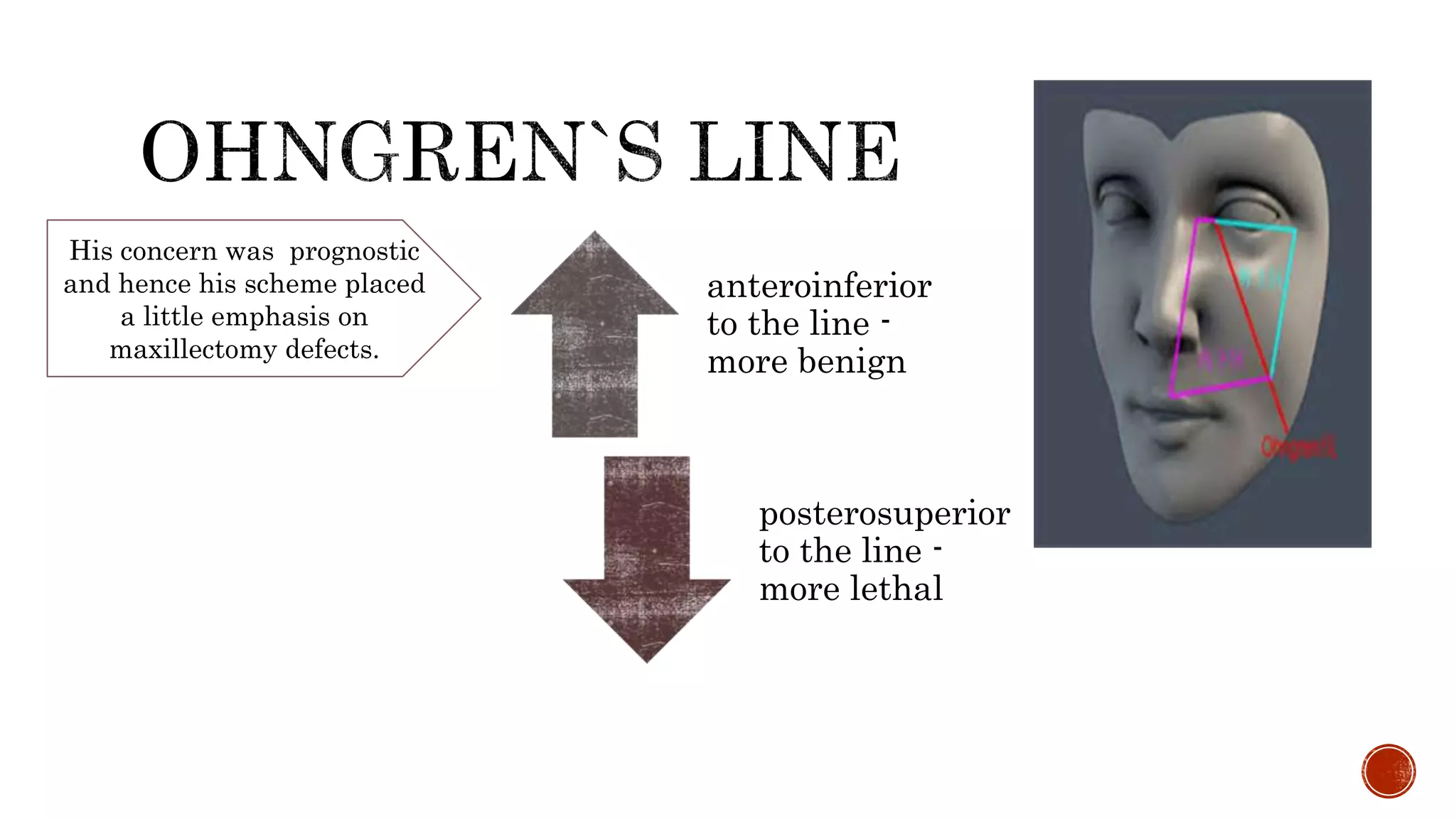 obturators / prosthodontic management of maxillectomy - part 1 | PPTX