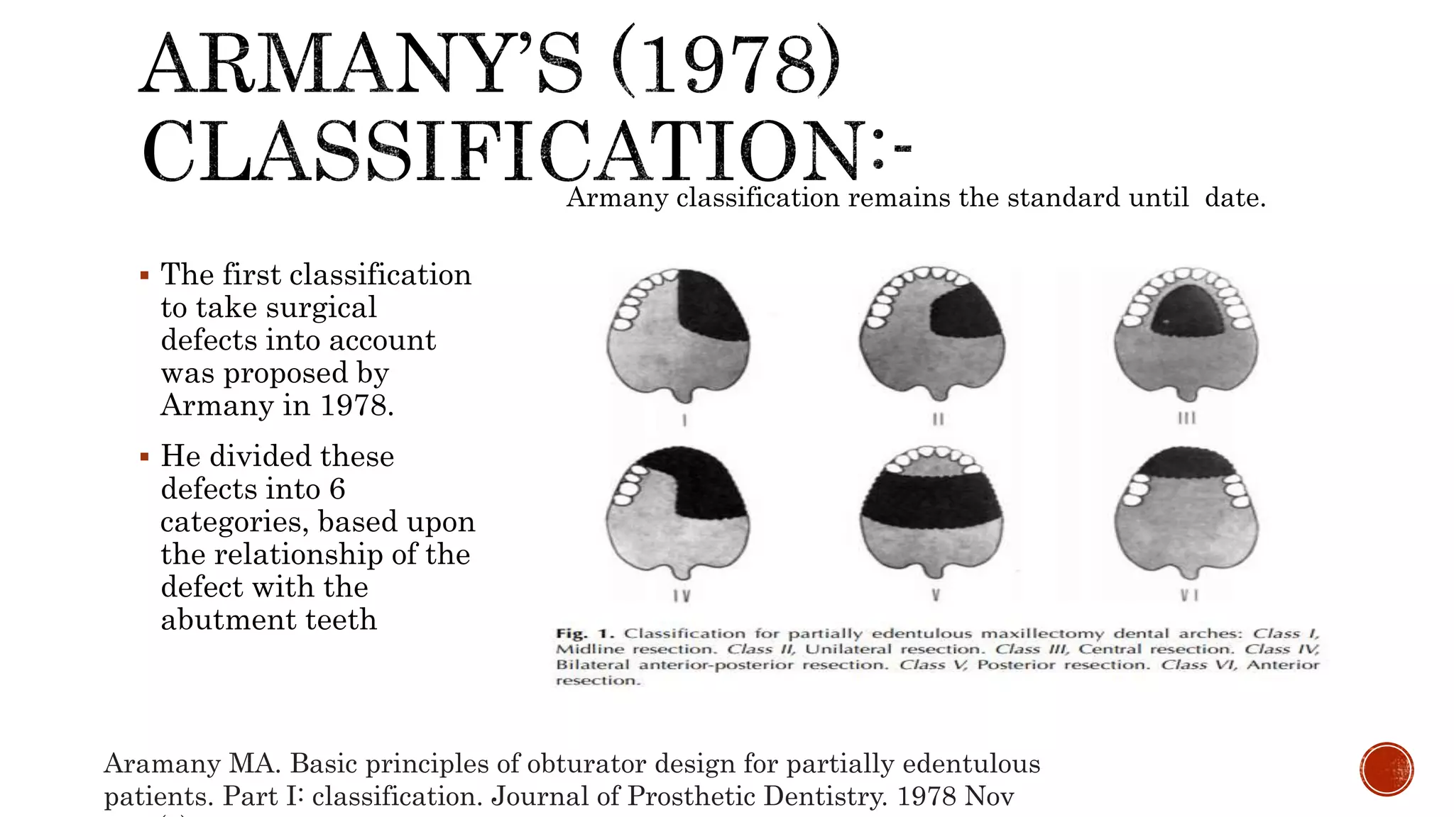 obturators / prosthodontic management of maxillectomy - part 1 | PPTX