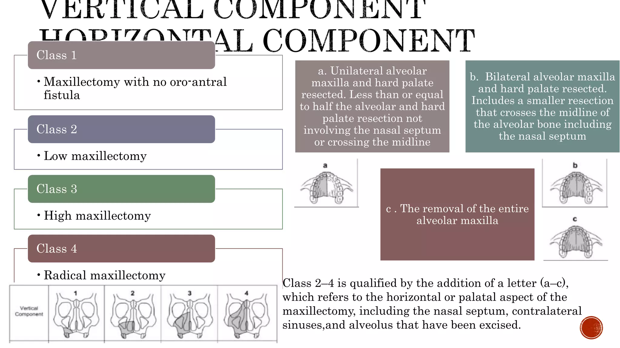 obturators / prosthodontic management of maxillectomy - part 1 | PPTX