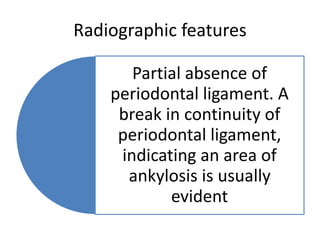 32.ankylosis or submerged teeth | PPTX