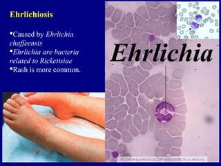 Important ticks and their classification | PPT