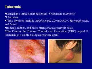 Important ticks and their classification | PPT