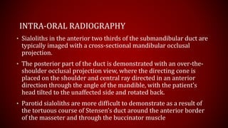 Radiographic Features of Normal and Abnormal Salivary Glands | PPTX