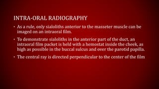 Radiographic Features of Normal and Abnormal Salivary Glands | PPTX