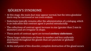 Radiographic Features of Normal and Abnormal Salivary Glands | PPTX
