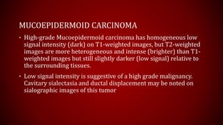 Radiographic Features of Normal and Abnormal Salivary Glands | PPTX