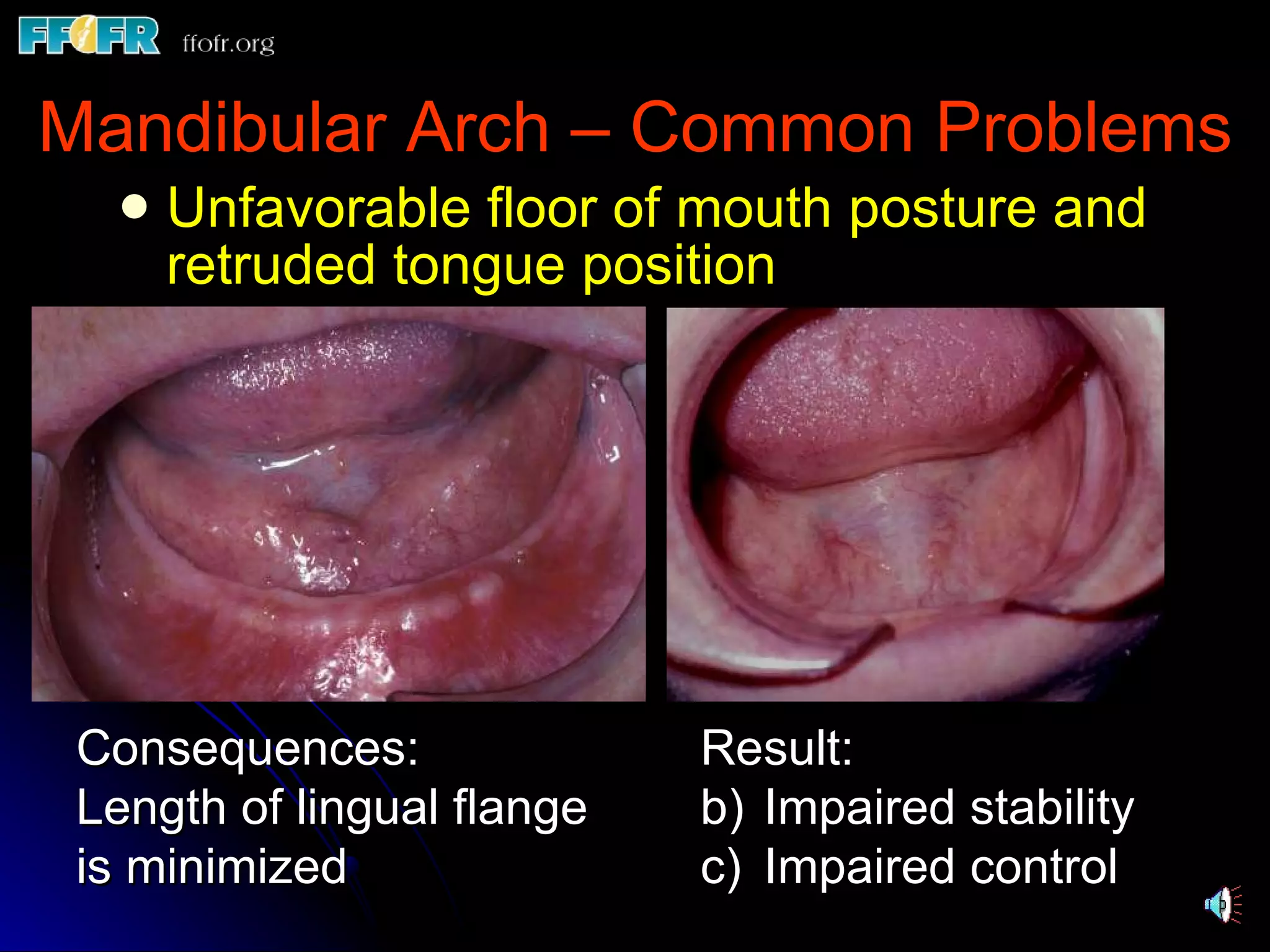 32.preprosthetic surgical procedures (n) | PPT