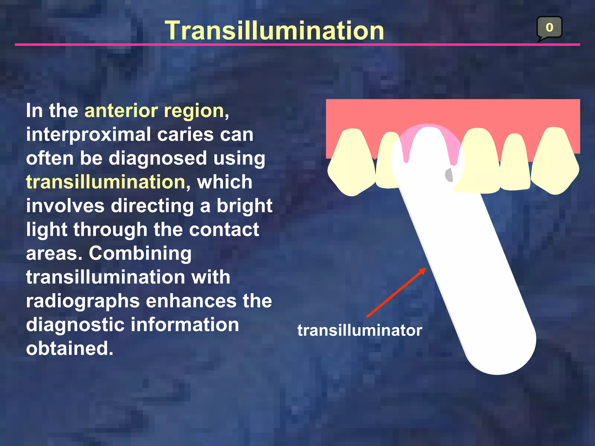 radiographic-caries-diagnosis | PDF