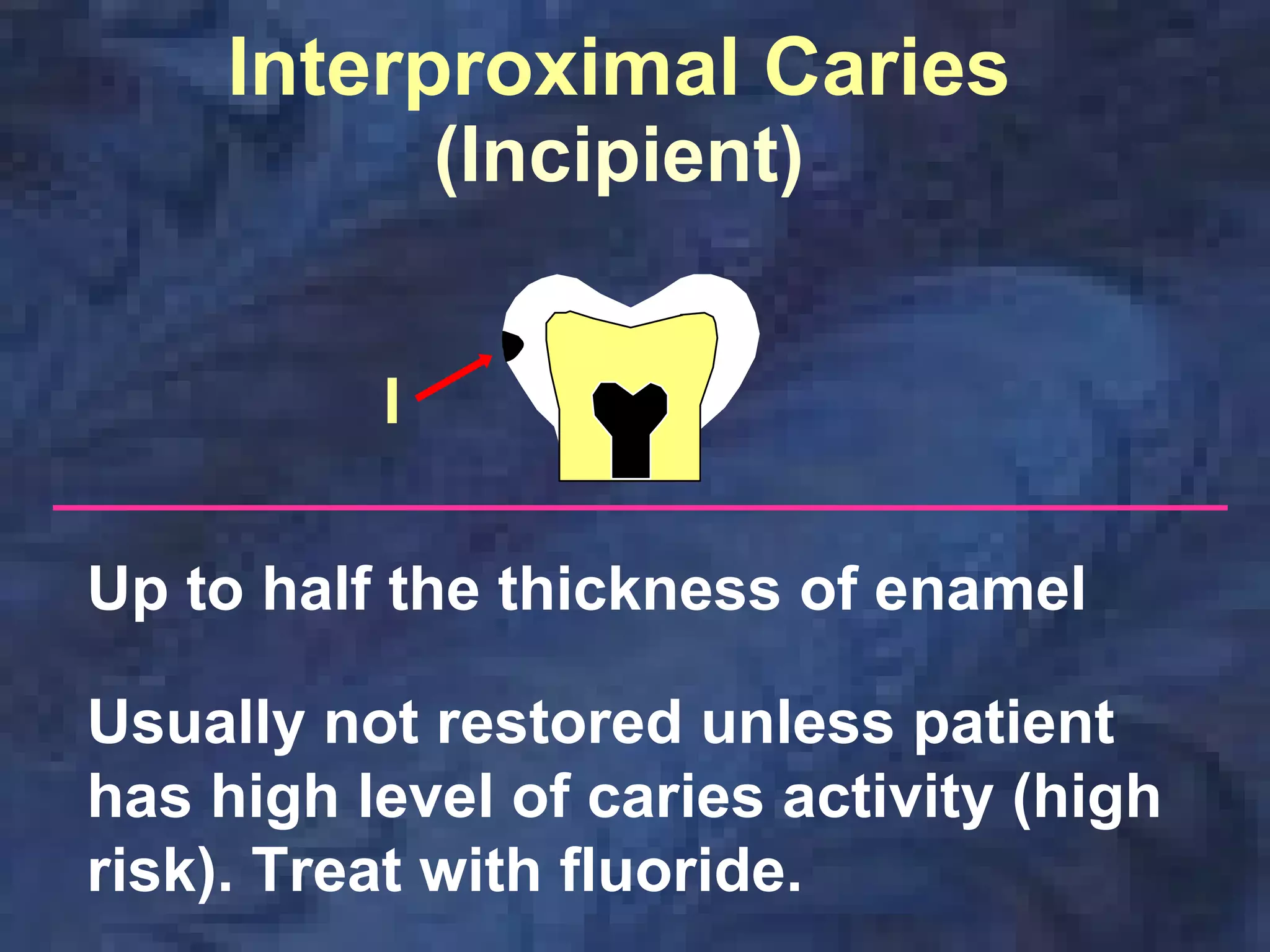 radiographic-caries-diagnosis | PDF