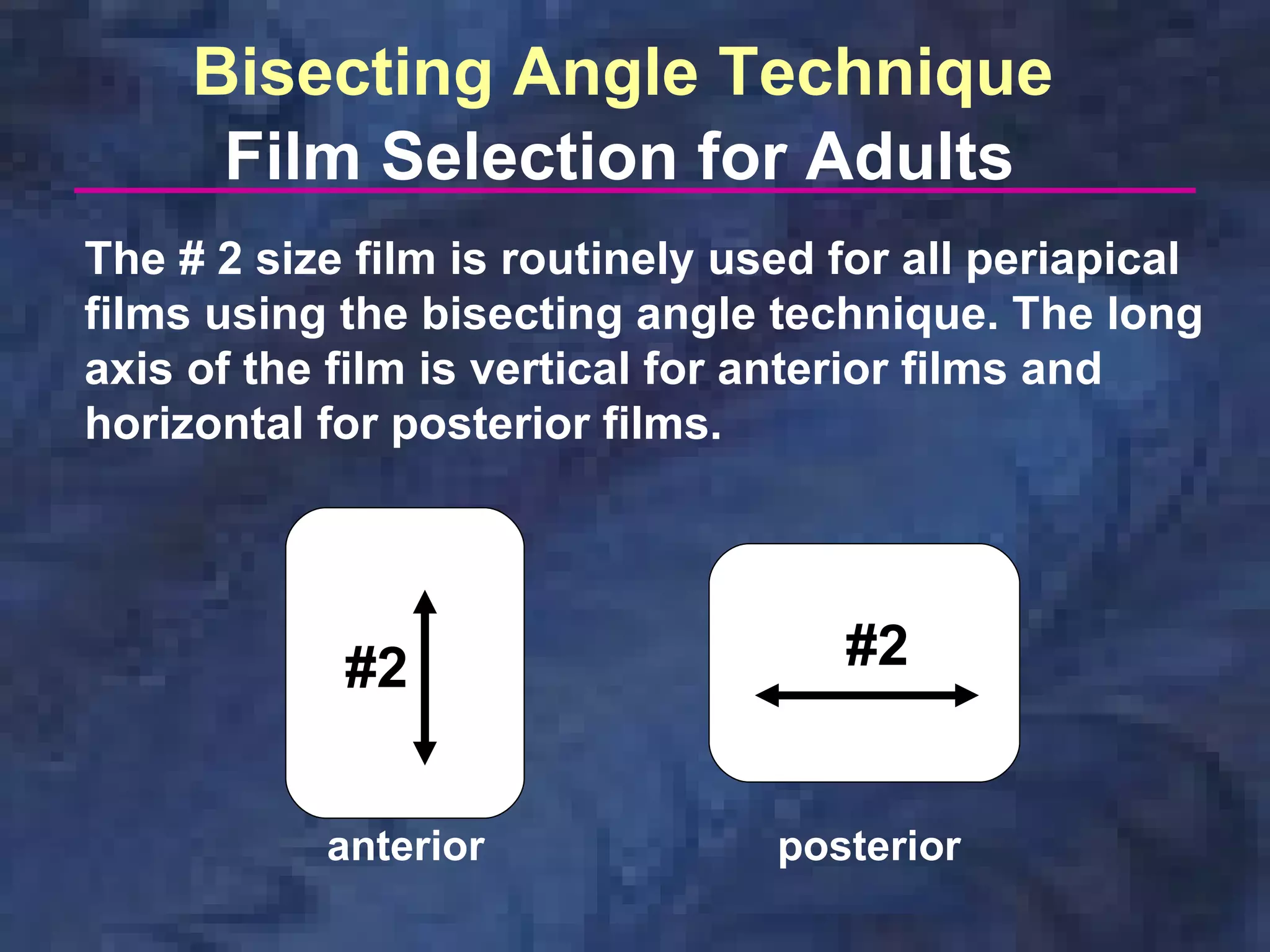 radio-graphic-techniques-bisecting-and-occlusal | PDF
